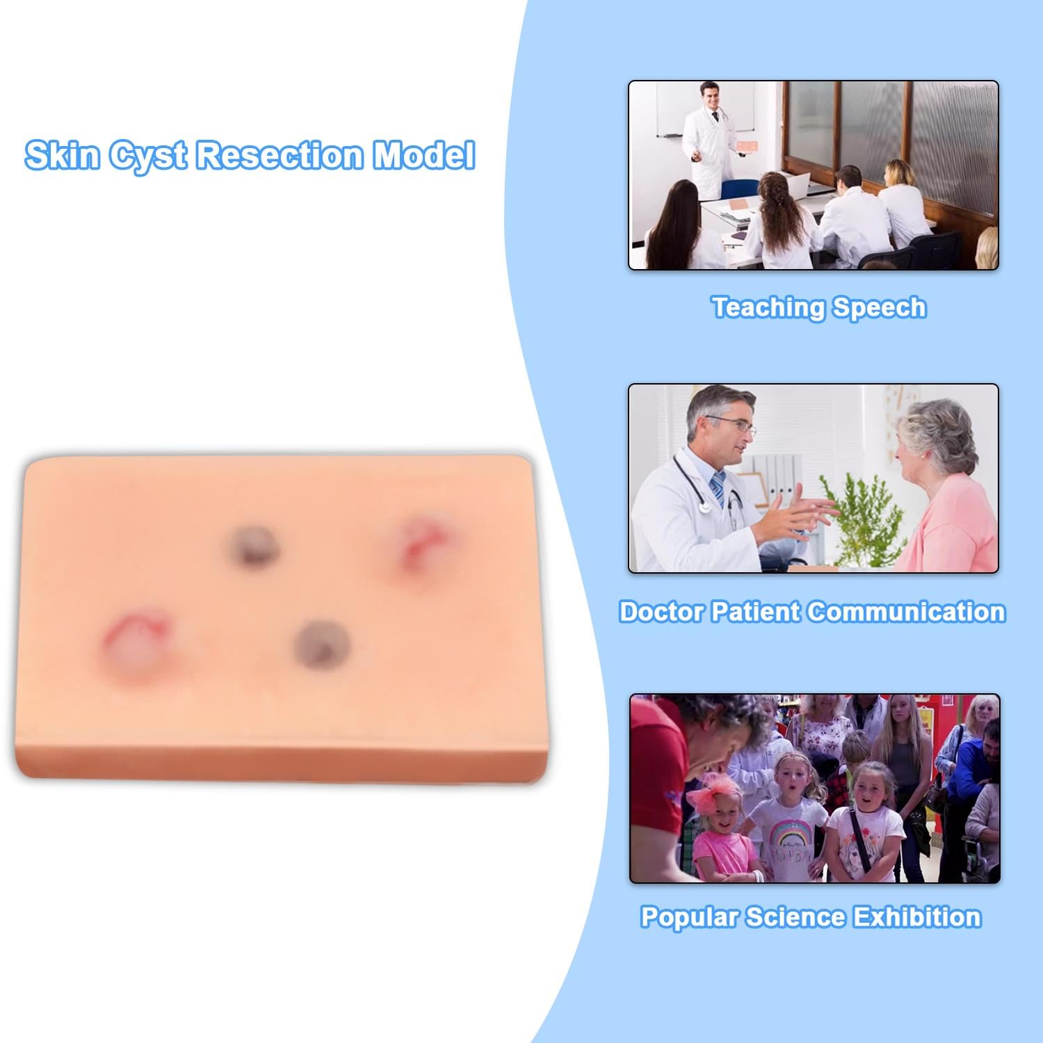 Snapklik.com : Skin Cyst Excision Training Model - Realistic Skin ...