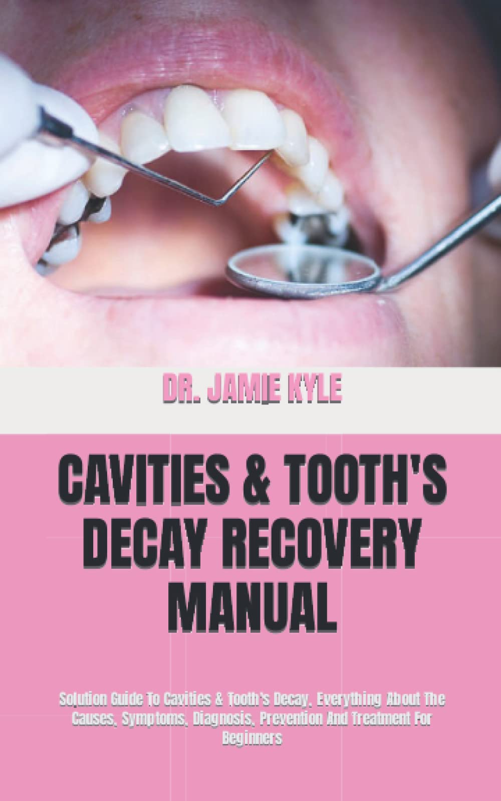 Buy CAVITIES & TOOTH'S DECAY RECOVERY MANUAL: Solution Guide To ...
