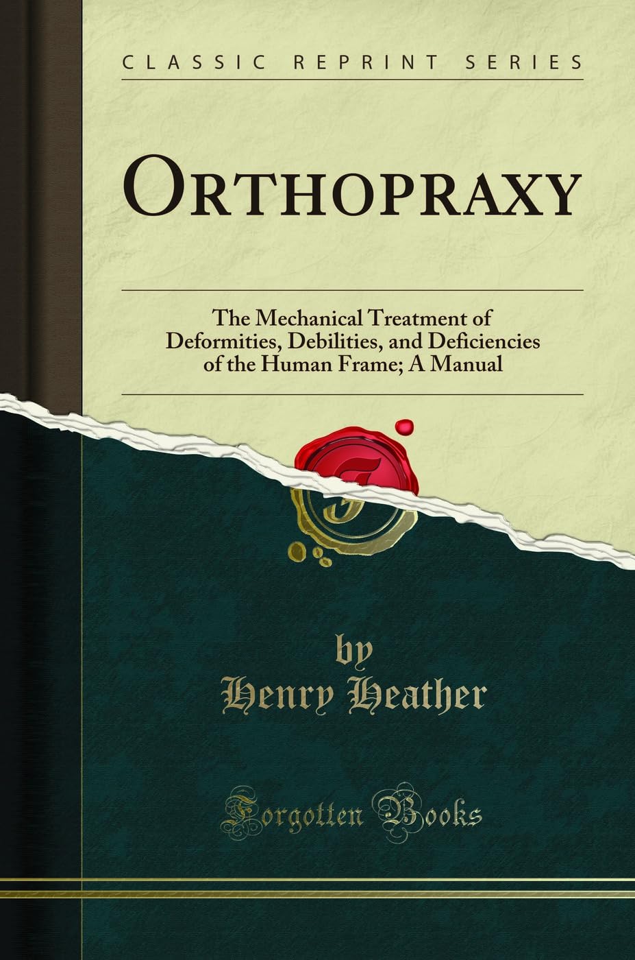 Orthopraxy: The Mechanical Treatment of Deformities, Debilities, and ...