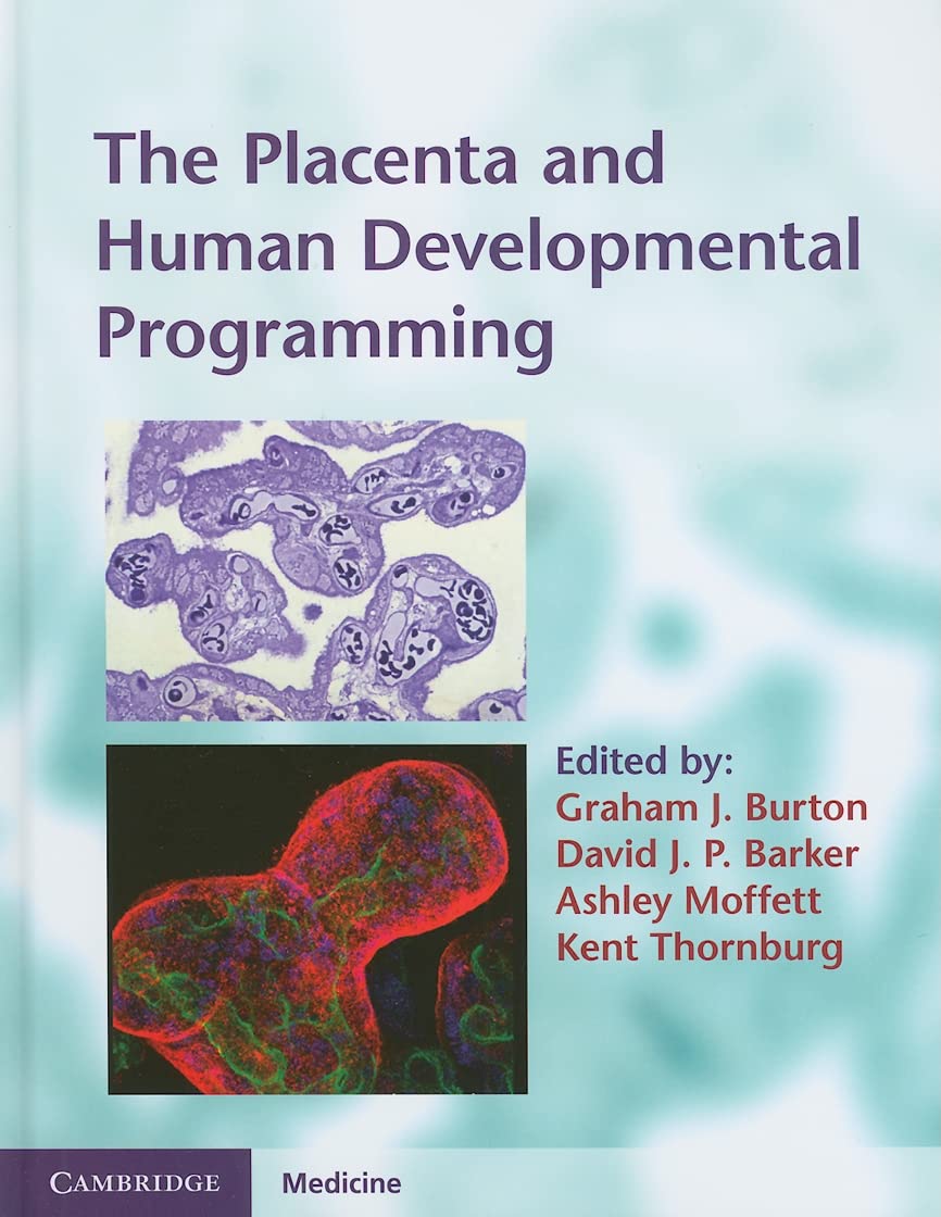 The Placenta and Human Developmental Programming : Buy Online at Best ...