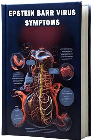 Epstein Barr Virus Symptoms: Learn about the symptoms of Epstein-Barr ...