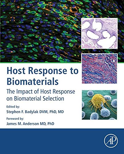 Host Response to Biomaterials: The Impact of Host Response on ...