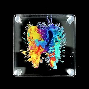 Amazon.com: Timethink (Set of 6) 4'' 3D Tooth Anatomy Coasters, Teeth ...