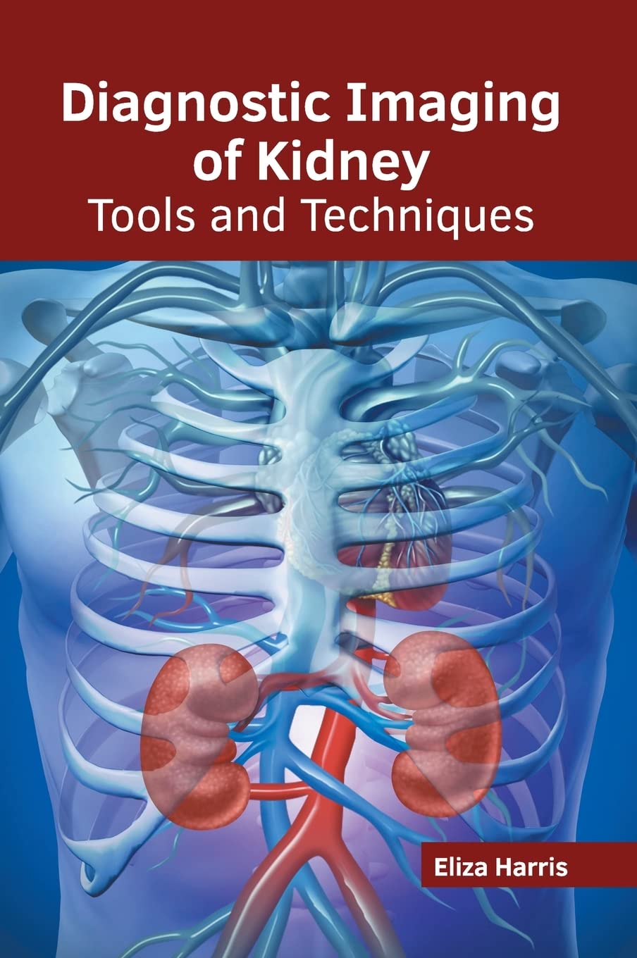 Diagnostic Imaging of Kidney: Tools and Techniques: 9781639891504 ...