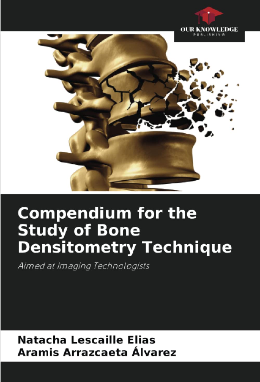 Compendium for the Study of Bone Densitometry Technique: Aimed at ...