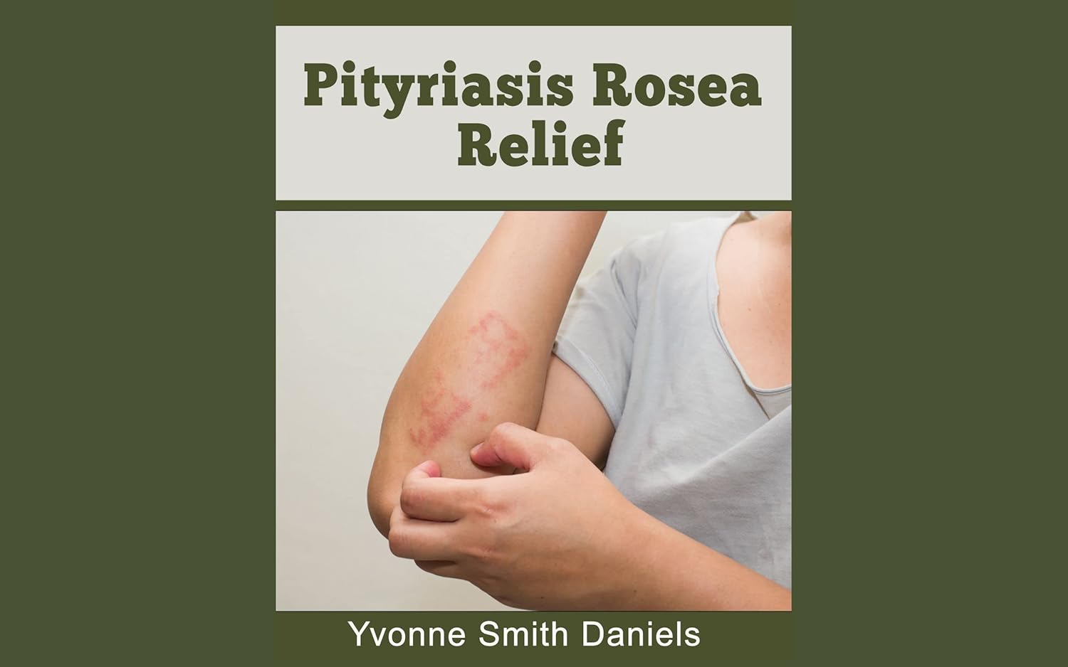 Pityriasis Rosea Relief: Itchy Dry Skin Rash Relief Ebook Pdf, Wellness ...