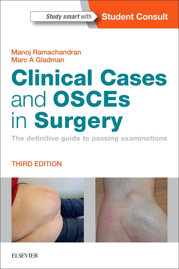 Clinical Cases and OSCEs in Surgery: The definitive guide to passing ...