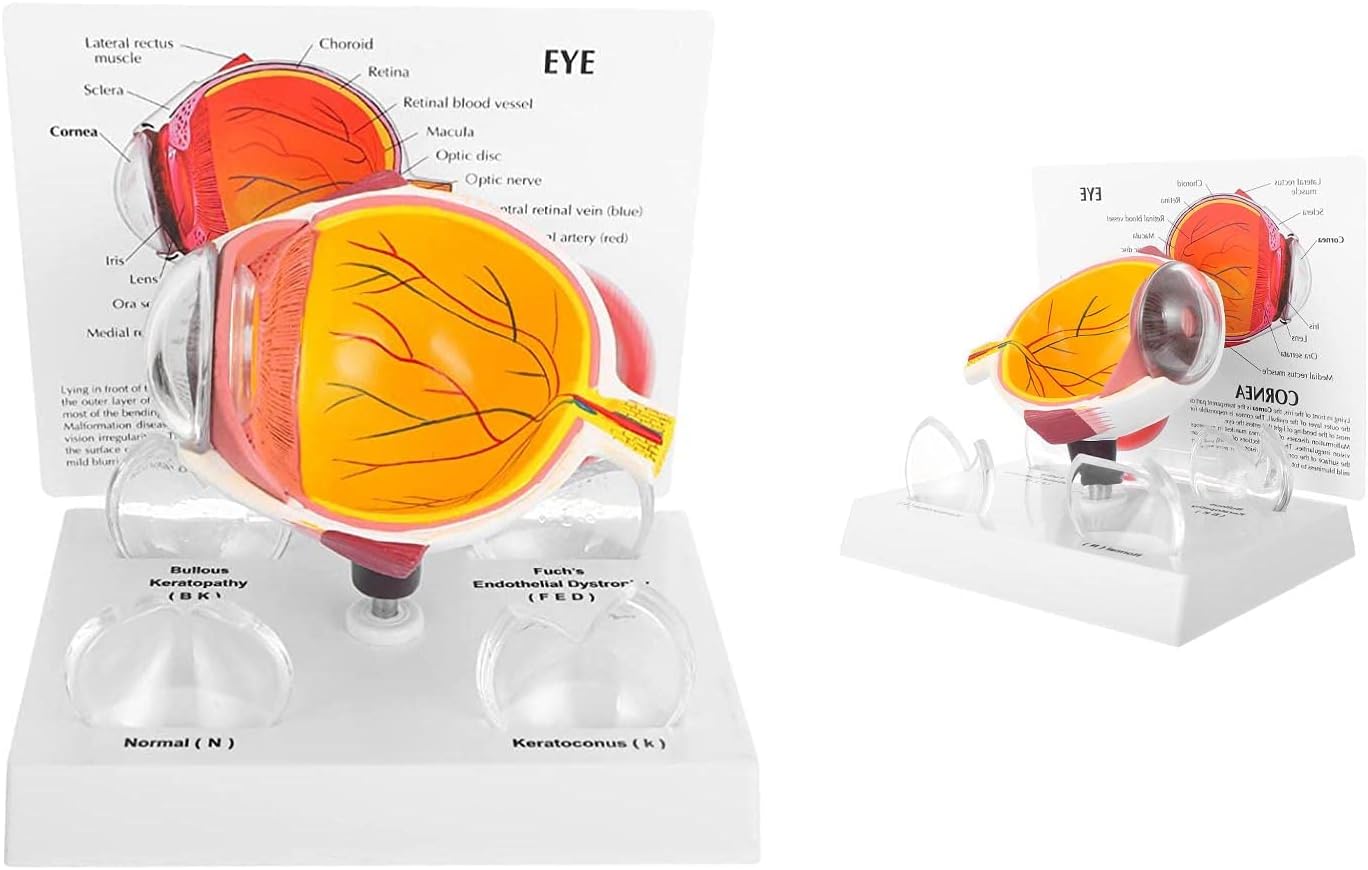 Amazon.com: LEMITA Human Eye Models Eyeball Model Cataract Eye Model ...