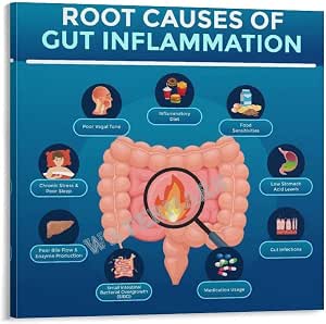 Amazon.com: SLRSWMYS Root Causes of Gut Inflammation Poster Hospital ...