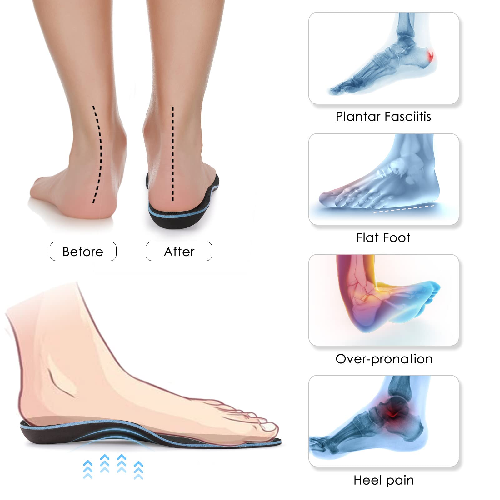 Insoles,Neutral Arch Supp...B0C3D5NHFW | Encarguelo.com.ec