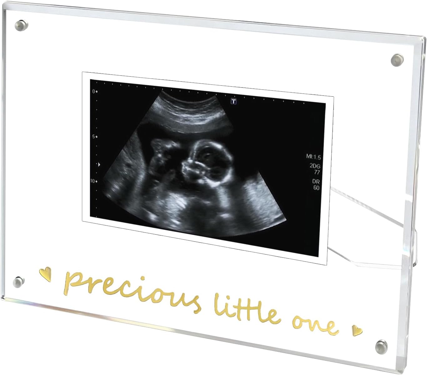Amazon.com: Zyeco A5 Magnetic Acrylic Ultrasound Picture Frame ...