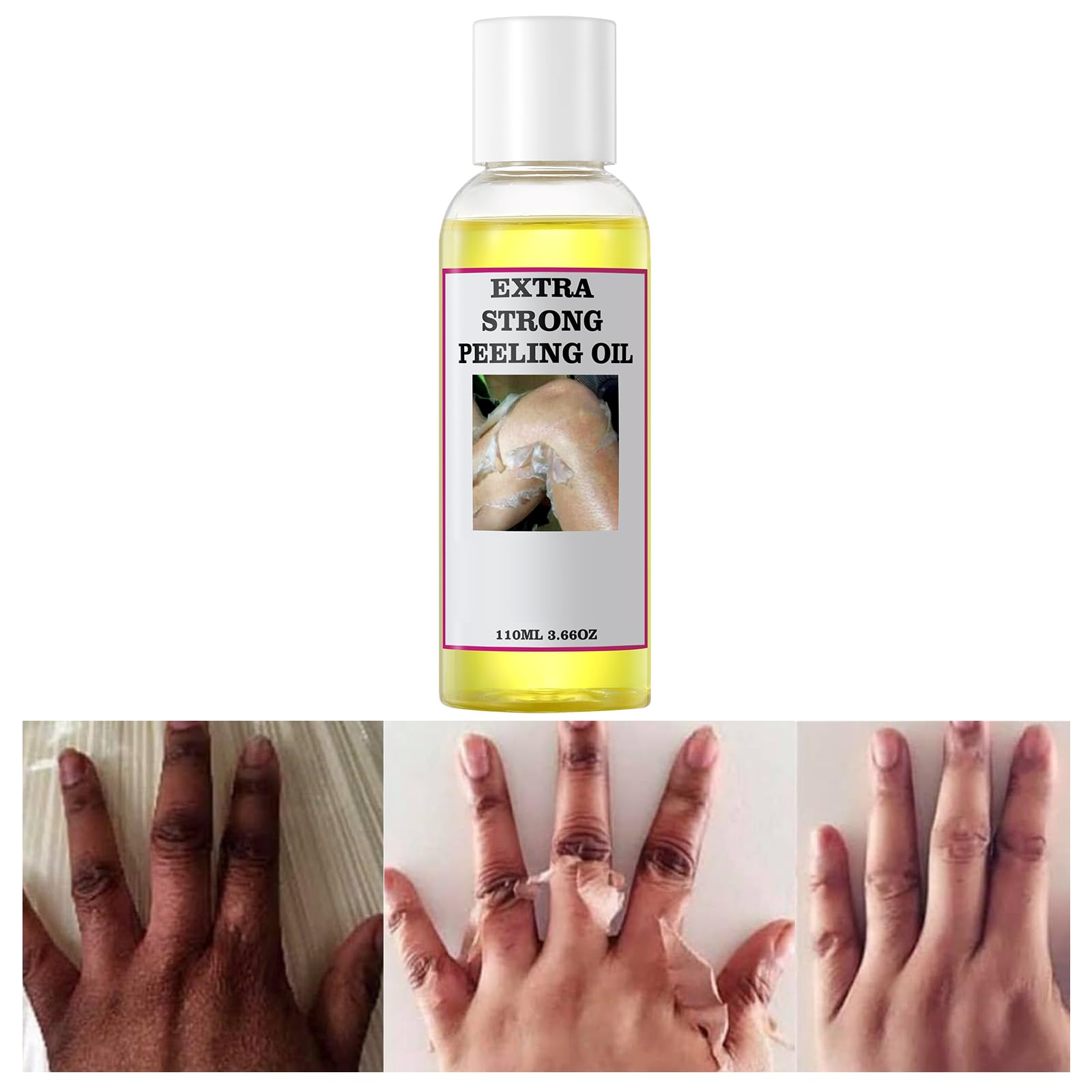 Peeling Oil for Dark Skin, Peeling Solution with Salicylic Acid ...