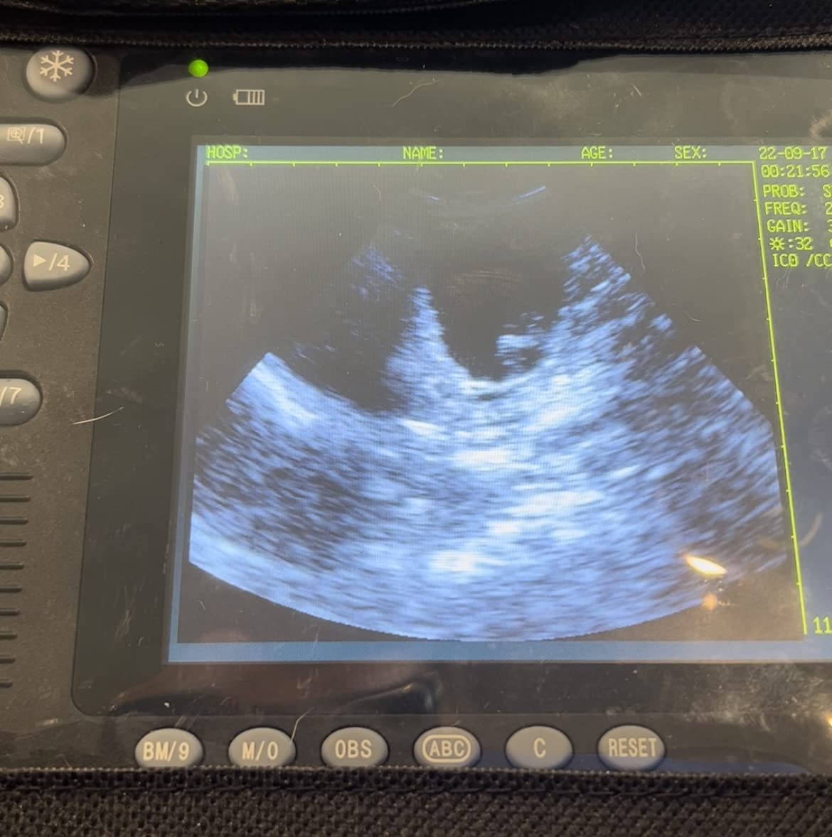 $69/mo - Finance 2023 Convex Newest Ultrasound Machine for Pregnancy ...