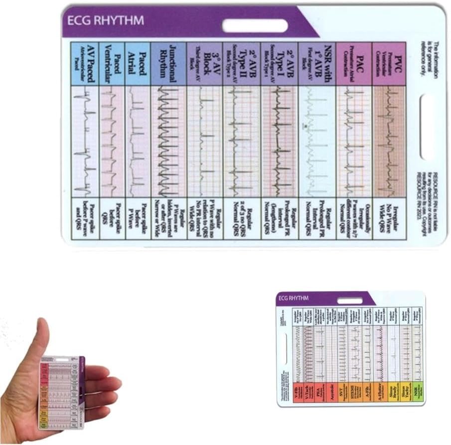 Amazon.com : 1PC ECG/EKG Rhythm Pocket Card Double Sided EKG Rhythm ...