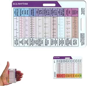 Amazon.com : 1PC ECG/EKG Rhythm Pocket Card Double Sided EKG Rhythm ...