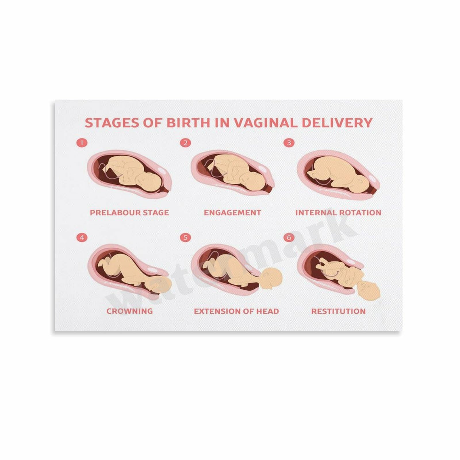 Stages Of Vaginal Delivery Amniotic Fluid During Pregnancy