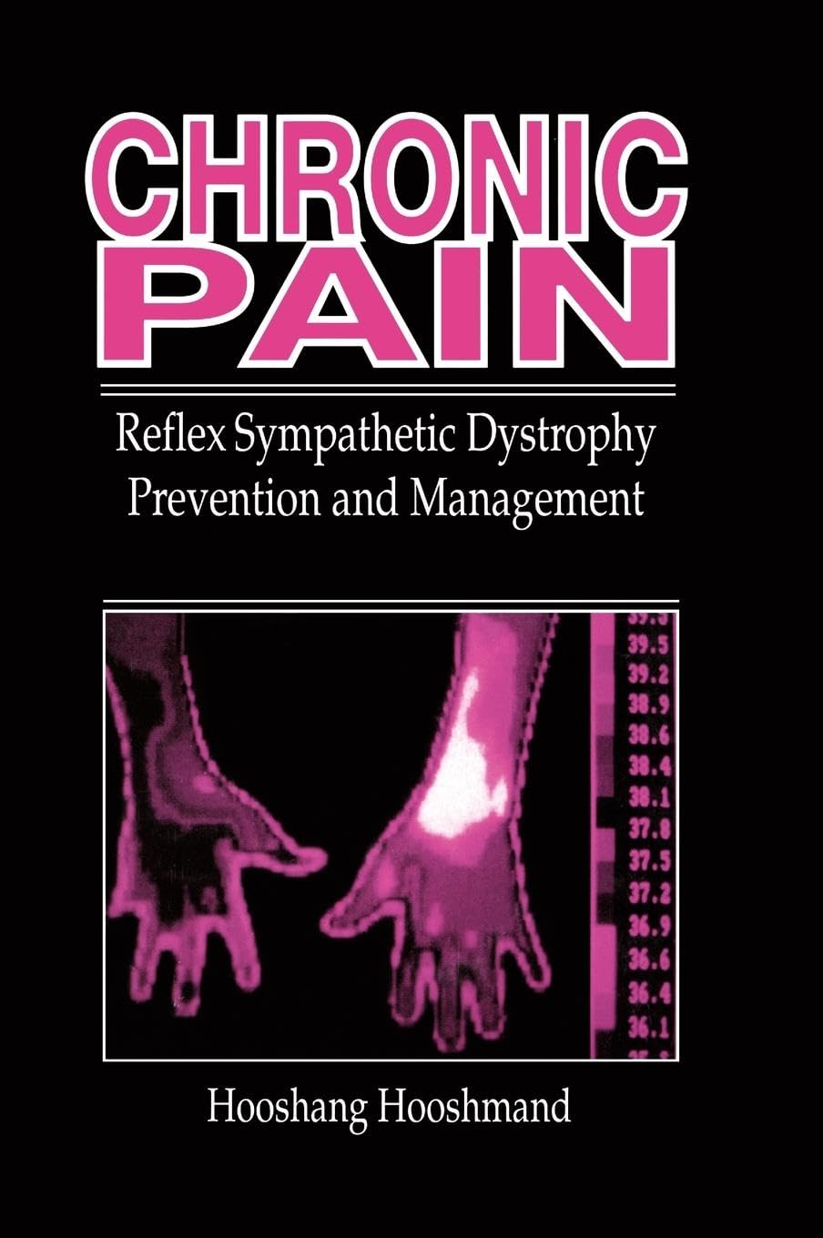 Chronic Pain: Reflex Sympathetic Dystrophy, Prevention, and Management ...
