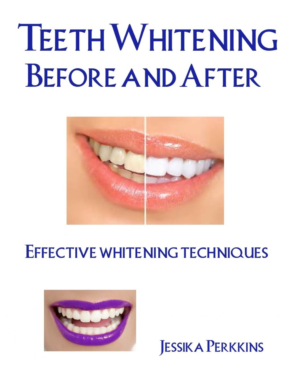 Teeth Whitening Before and After: Effective whitening techniques ...