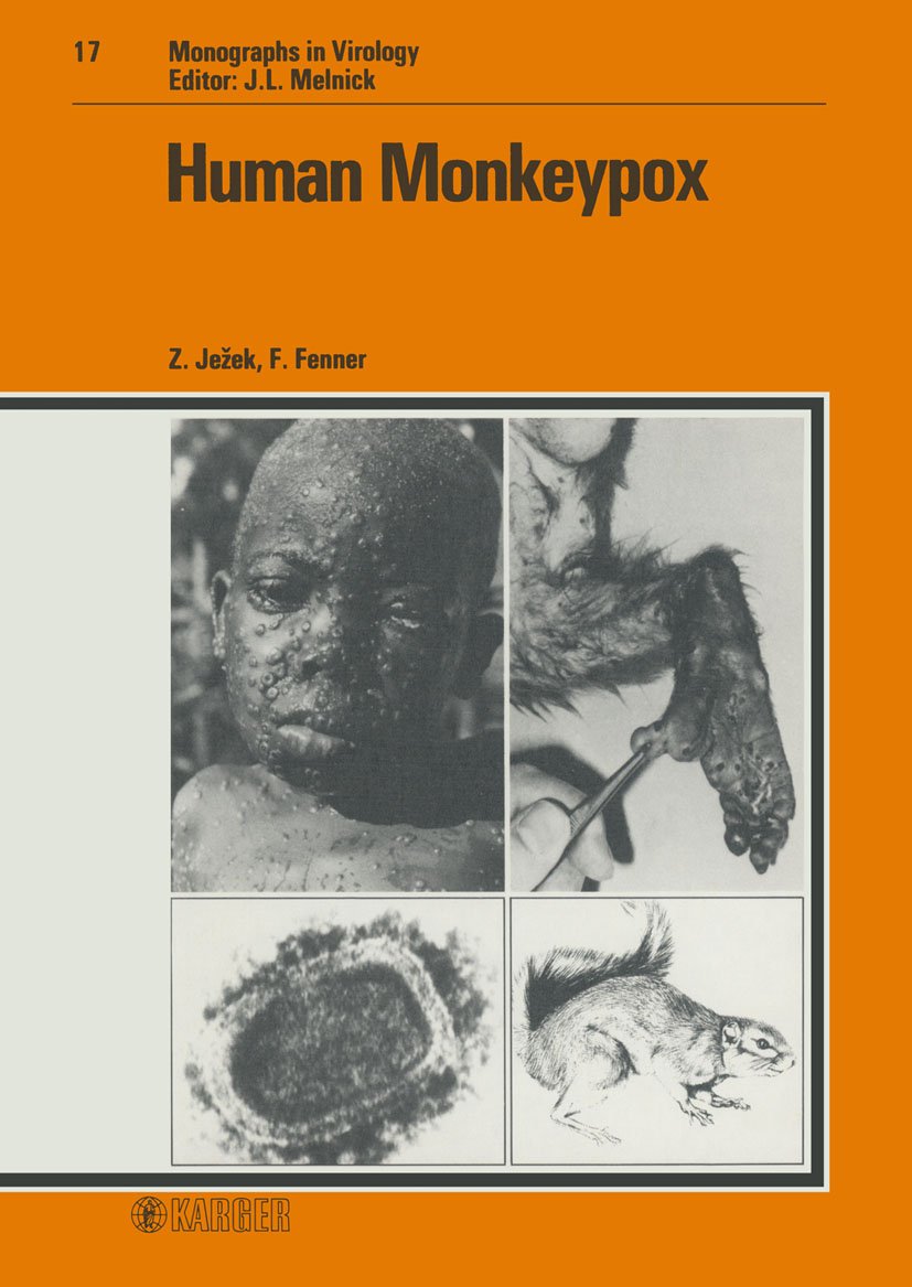 Human Monkeypox (Monographs in Virology): 9783805548182: Medicine ...