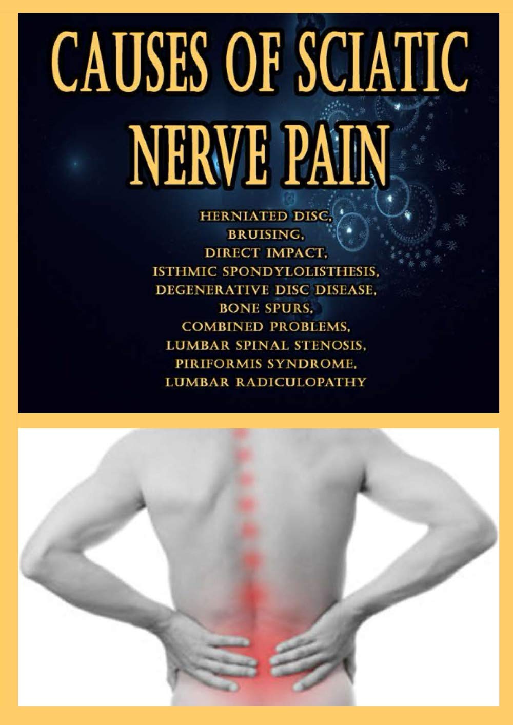 Buy Causes of Sciatic Nerve Pain: Herniated Disc, Bruising, Direct ...