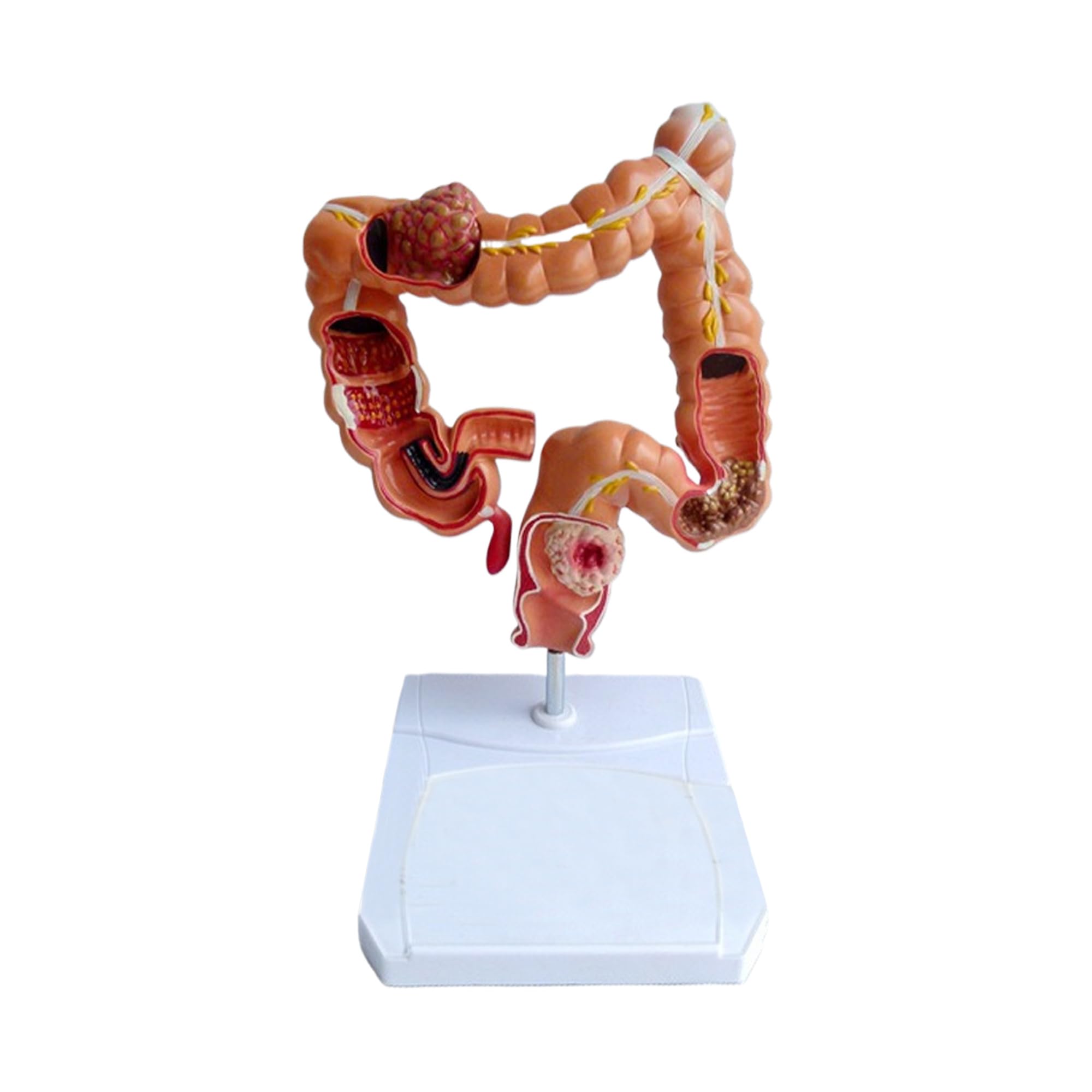 Colon Anatomy