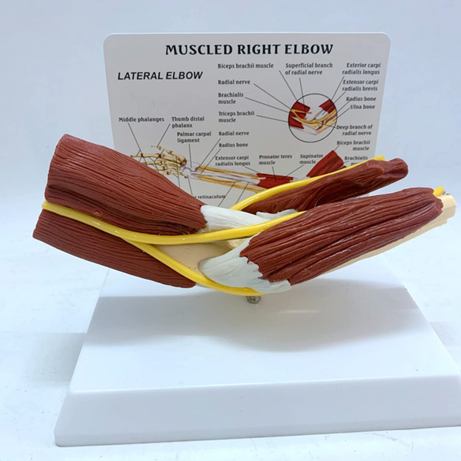 Buy Elbow Joint Nerve Ligament Model, Scientific Functional Arm ...