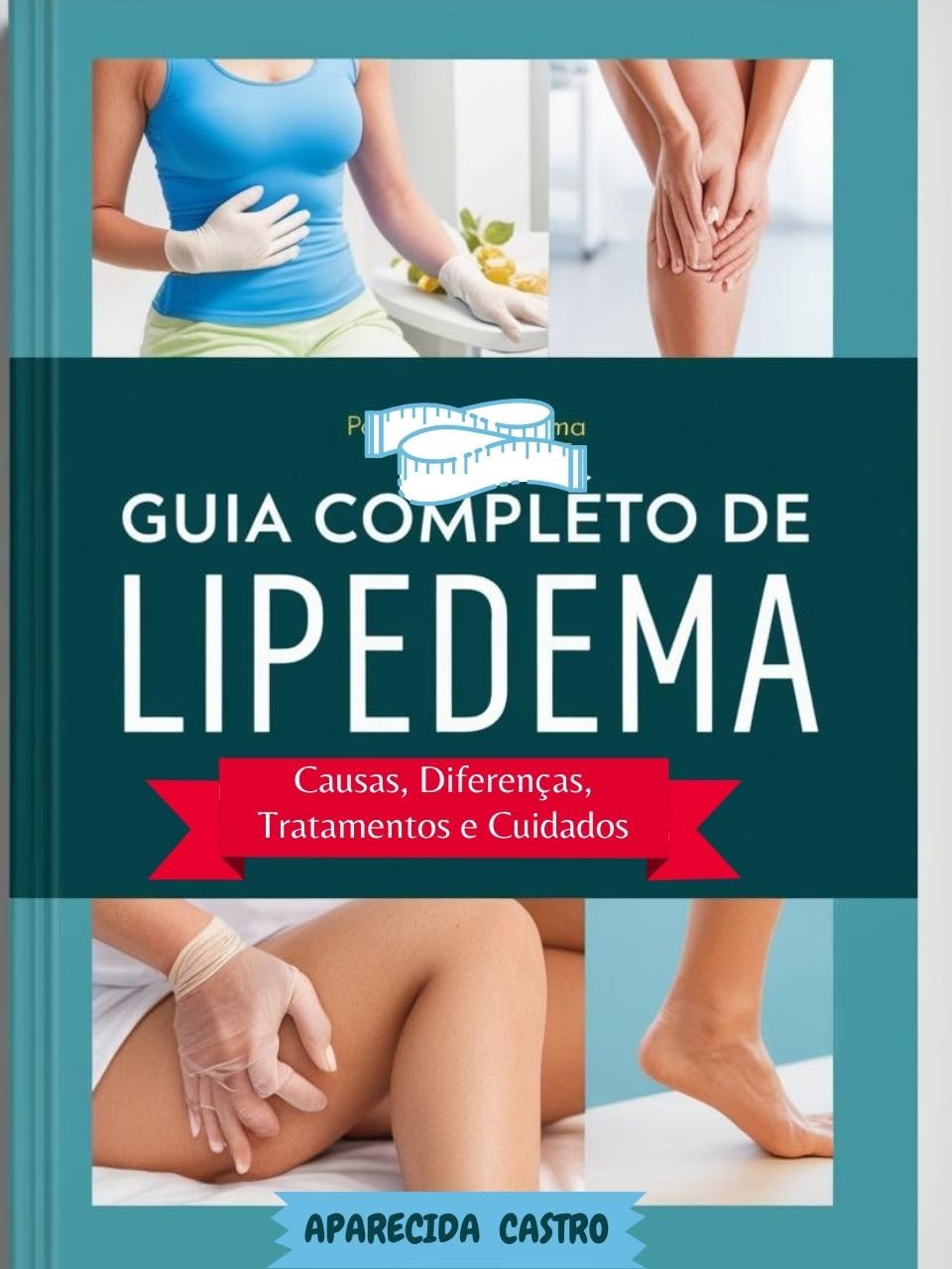 Guia Completo sobre Lipedema : Causas diferenças e cuidados (Portuguese ...