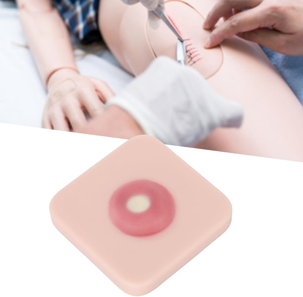 Abscess Incision Drainage Pad, Sebaceous Cyst Sri Lanka | Ubuy