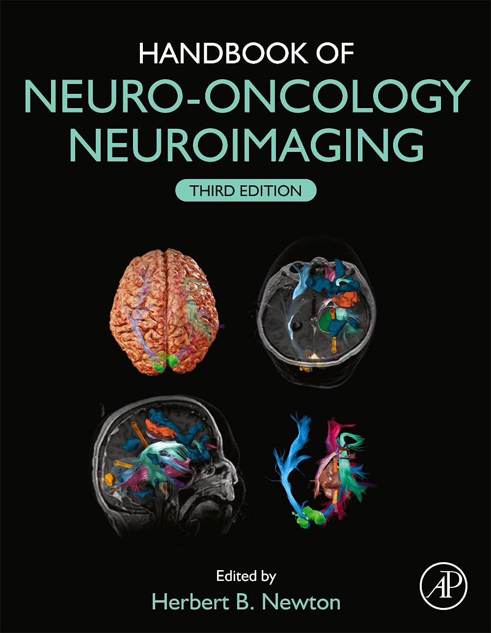 Handbook of Neuro-Oncology Neuroimaging: 9780128228357: Medicine ...