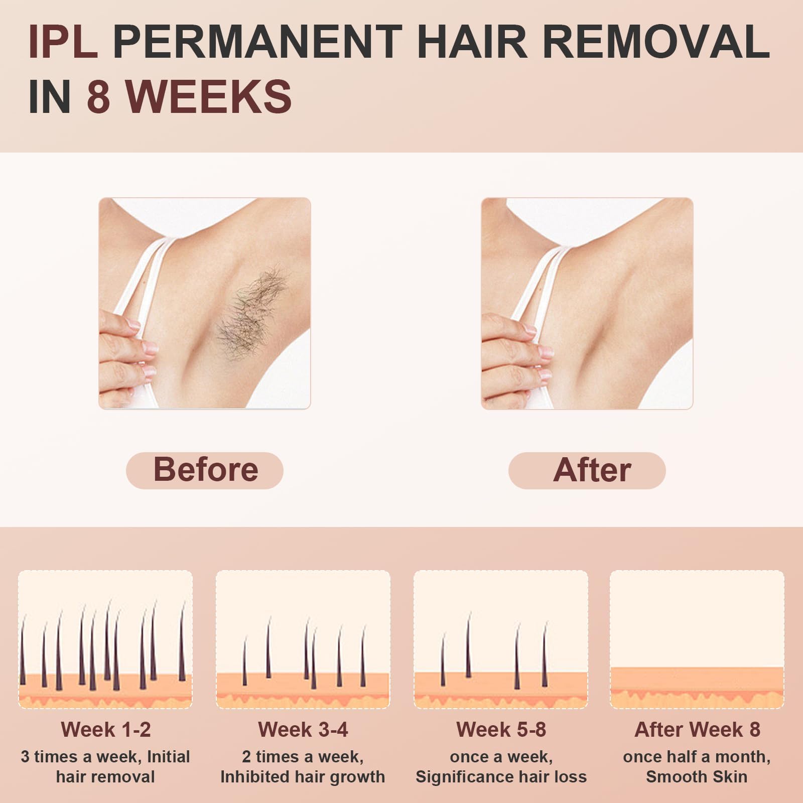 Male Genital Hair Removal Permanent