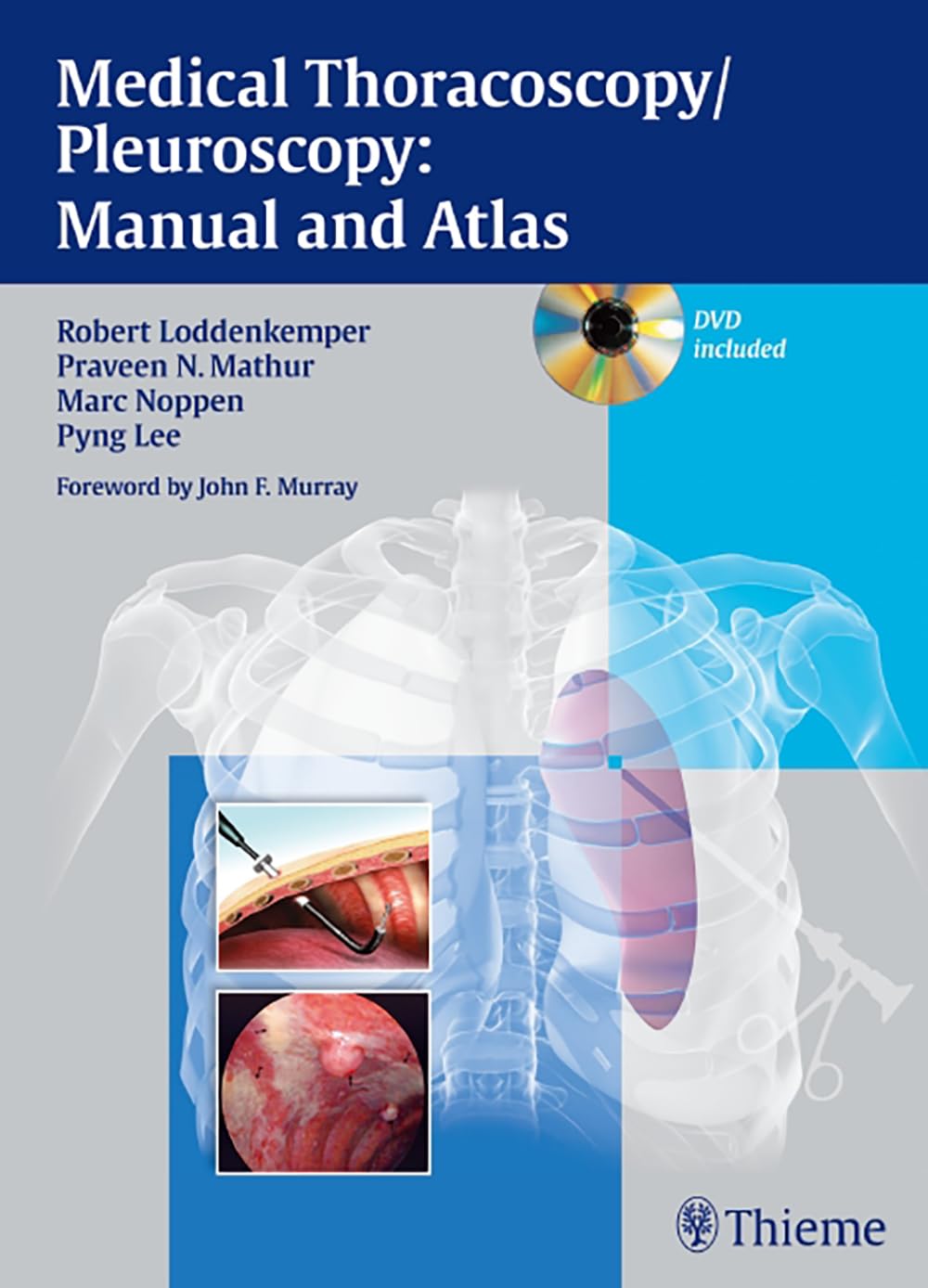 Medical Thoracoscopy / Pleuroscopy: Manual and Atlas: 9783131082213 ...