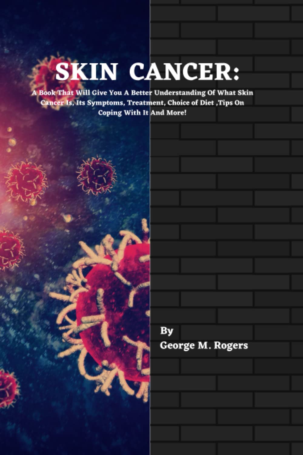 SKIN CANCER: A Book That Will Give You A Better Understanding Of What ...