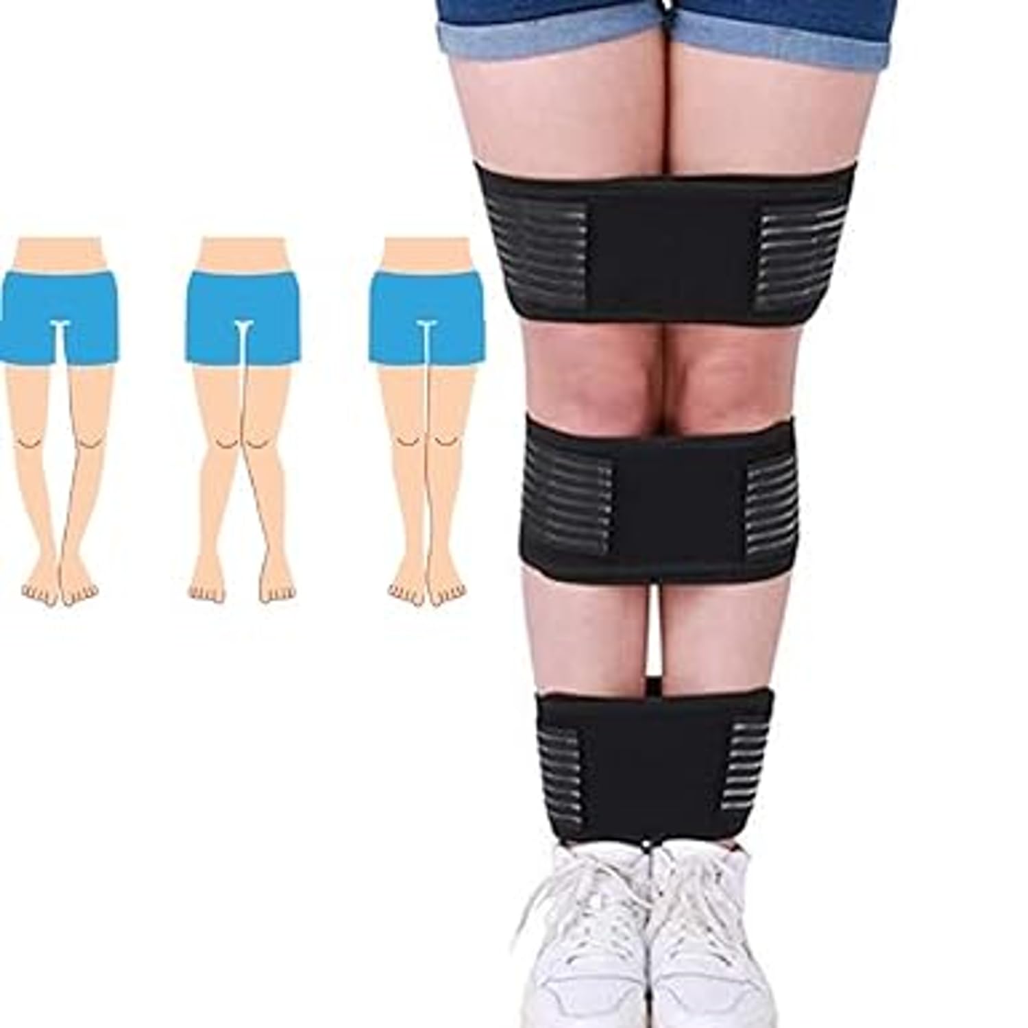 Buy CAREOPETA Bow Leg Corrector Belt for Men Women O/X Type Leg Posture ...