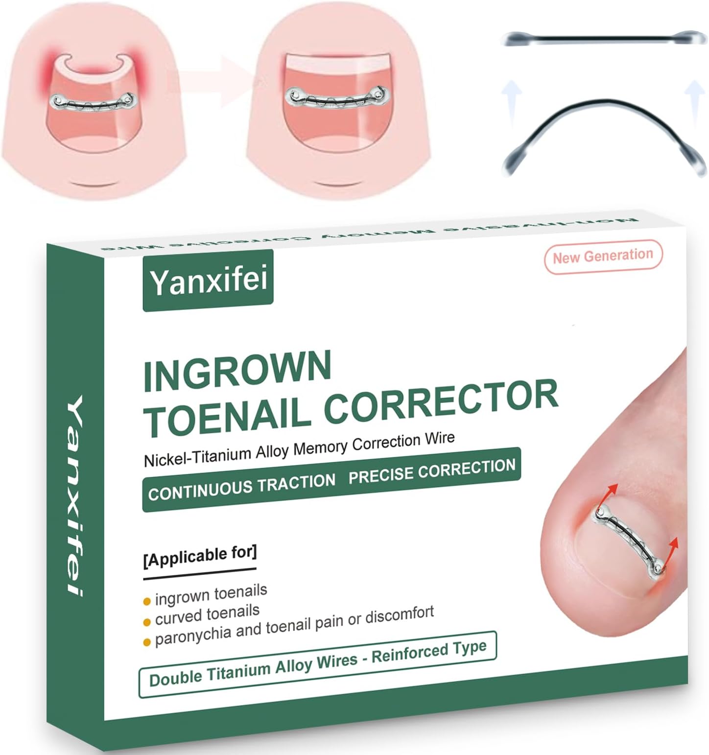 Amazon.com: Titanium Alloy Ingrown Toenail Treatment, Ingrown Toenail ...
