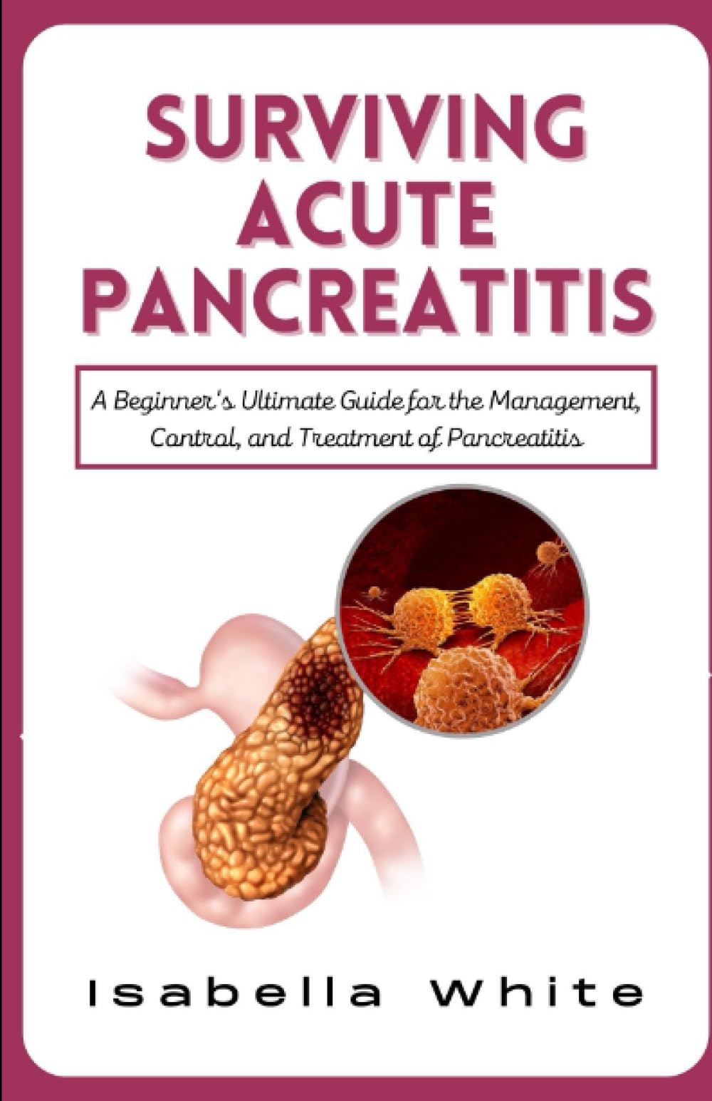 Buy Surviving Acute Pancreatitis: A Beginner's Ultimate Guide for the ...