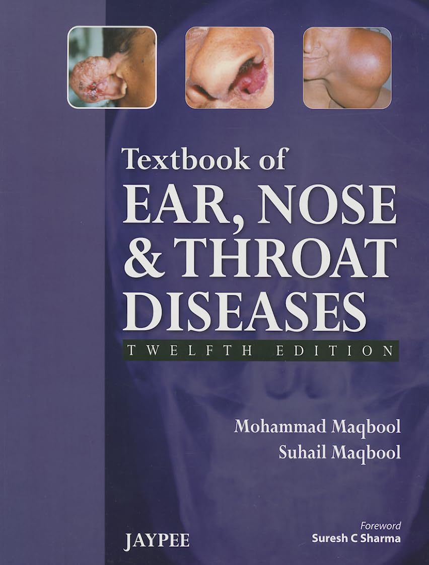 Textbook of Ear, Nose and Throat Diseases: 9789350904954: Medicine ...