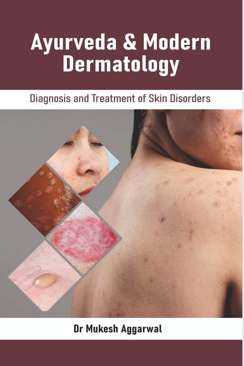 Dermatology Diseases