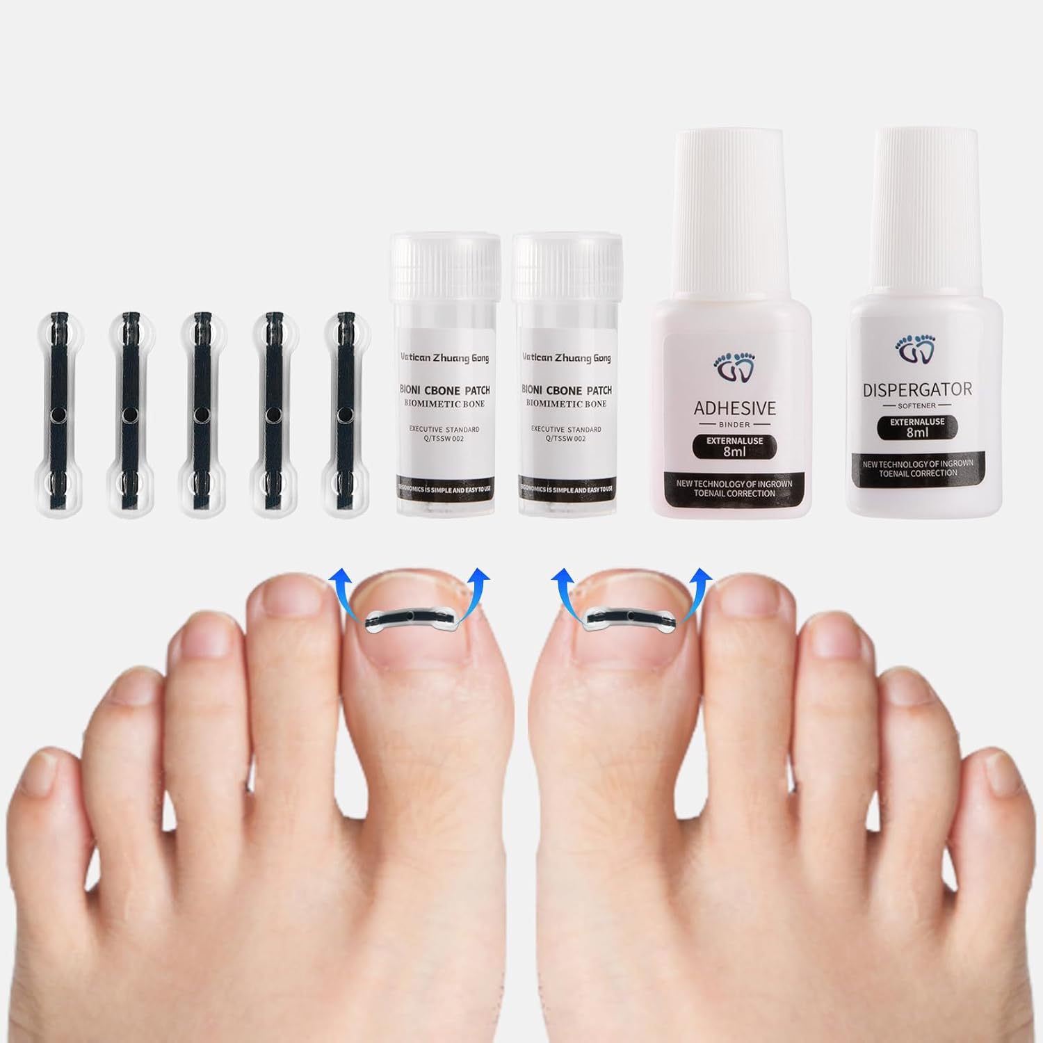 Amazon.com: 5 PCS Titanium Alloy Ingrown Toenail Treatment, Ingrown ...