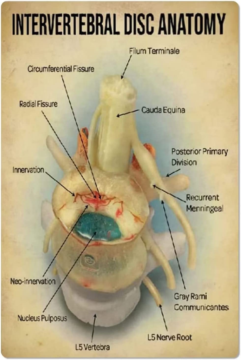 Intervertebral Disc Anatomy Lumbar Disc Herniation