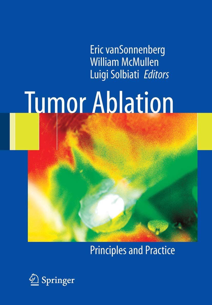 Tumor Ablation: Principles and Practice: 9780387955391: Medicine ...