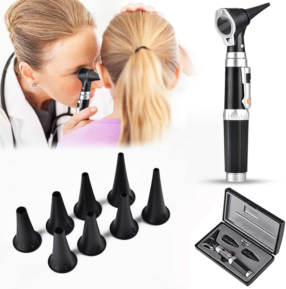 Amazon.co.uk: Auroscope