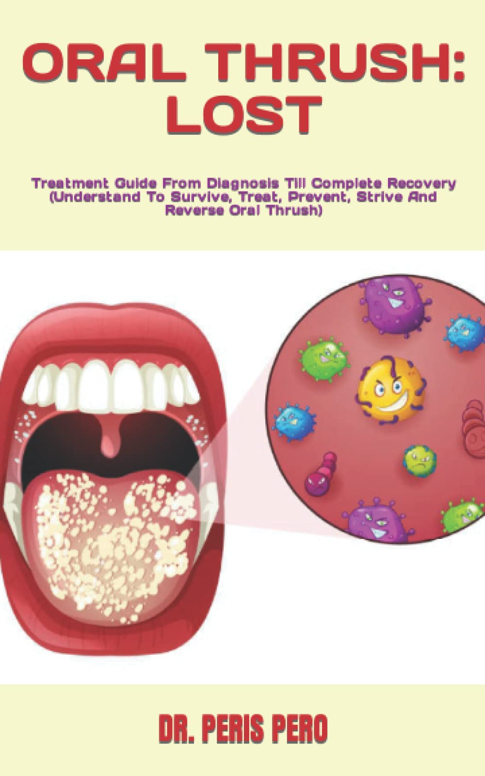 Buy ORAL THRUSH: LOST: Guide From Diagnosis Till Complete Recovery ...