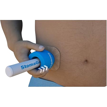 Amazon.com: STOMAGENIE Stoma Waste Capture Device - 10-Pack (7/8 ...