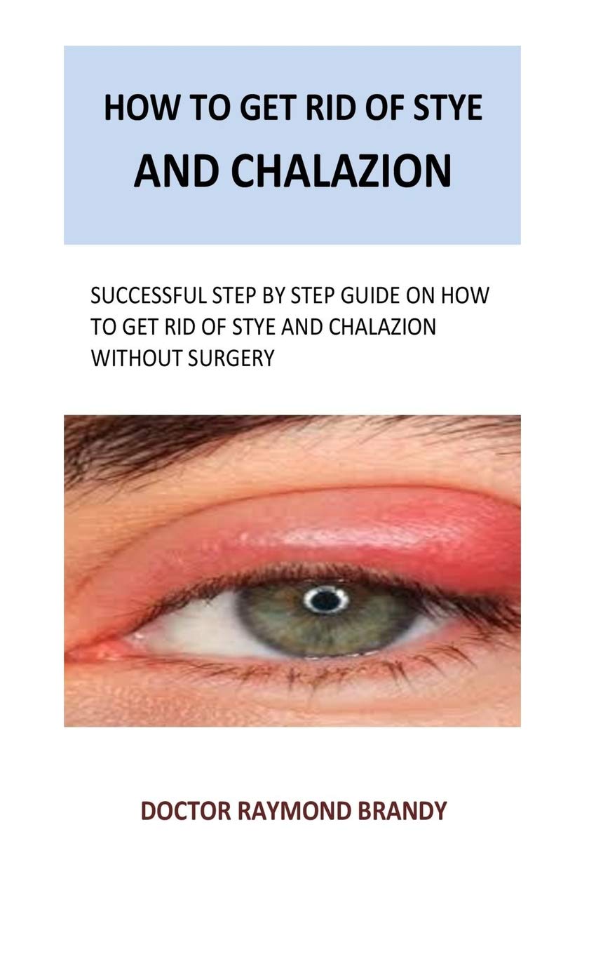 Buy How to get rid of stye and chalazion: Successful step by step guide ...