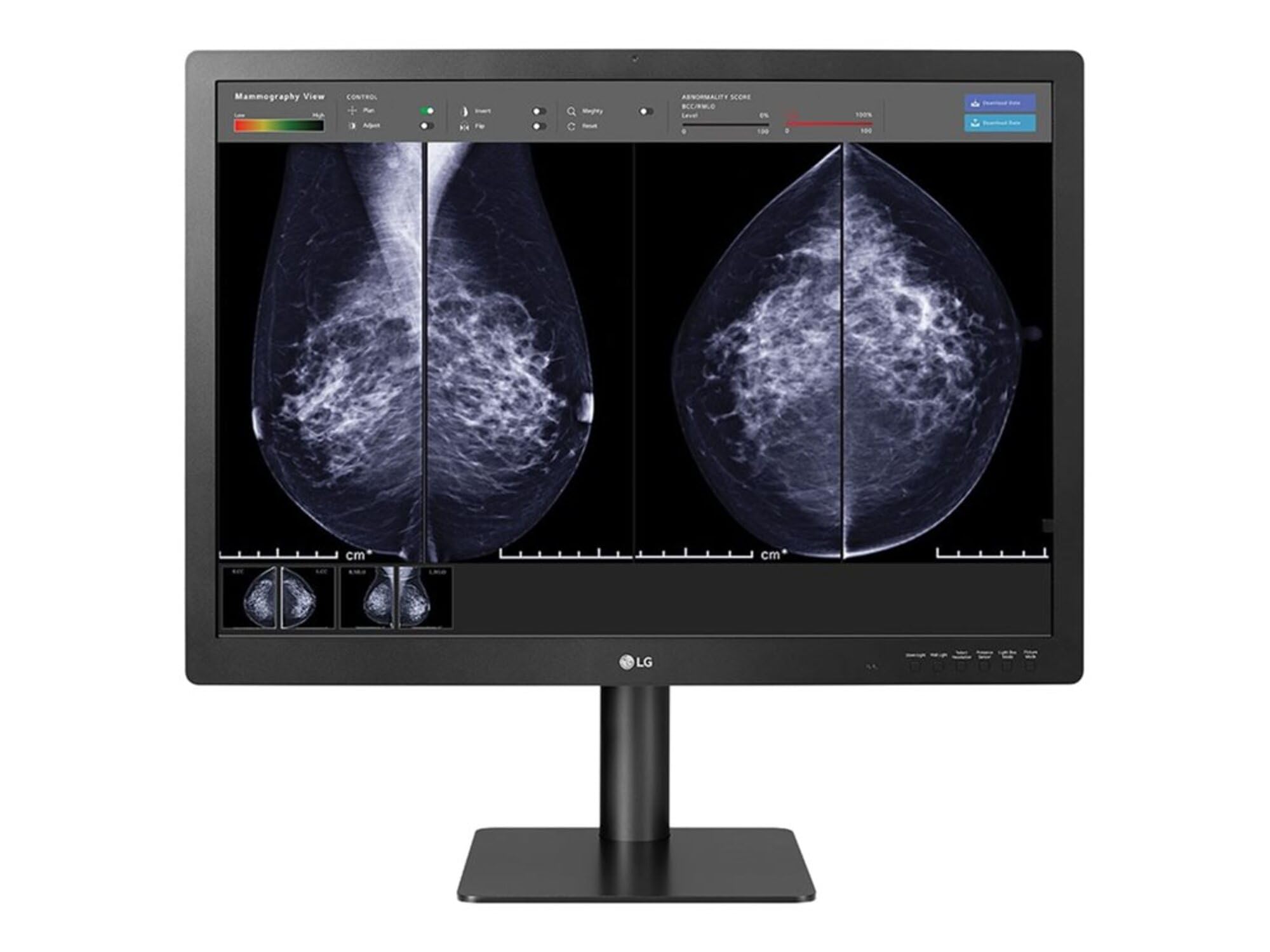 Amazon.com: LG 31IN Medical Anti-Glare, 3H DIGNOSTIC Monitor 4200 X ...
