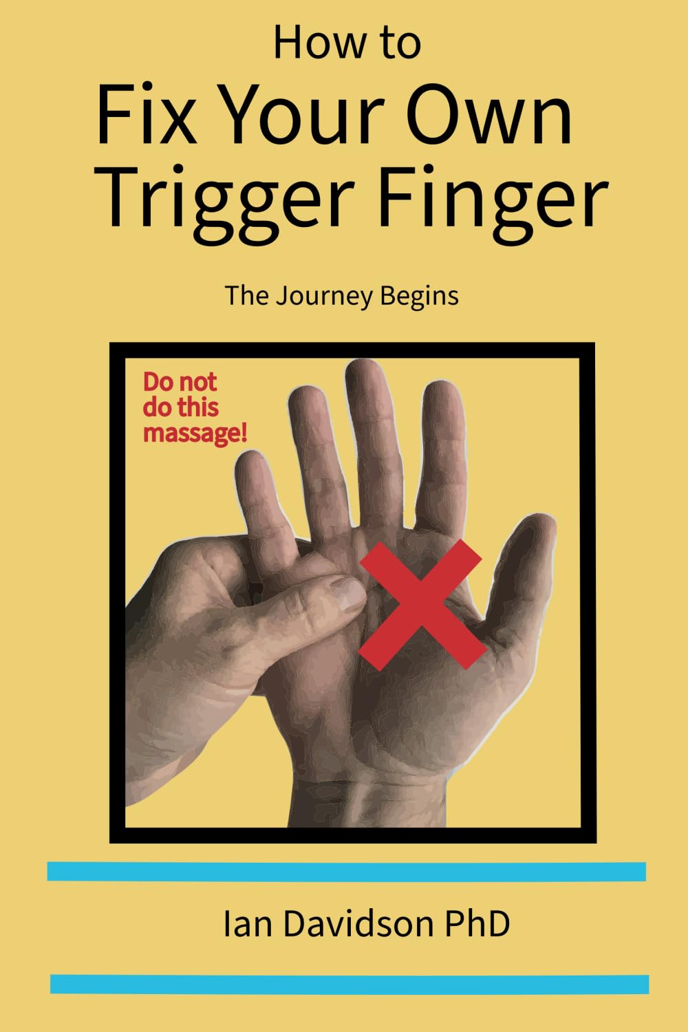 How to Fix Your Own Trigger Finger: The Journey Begins: Davidson PhD ...