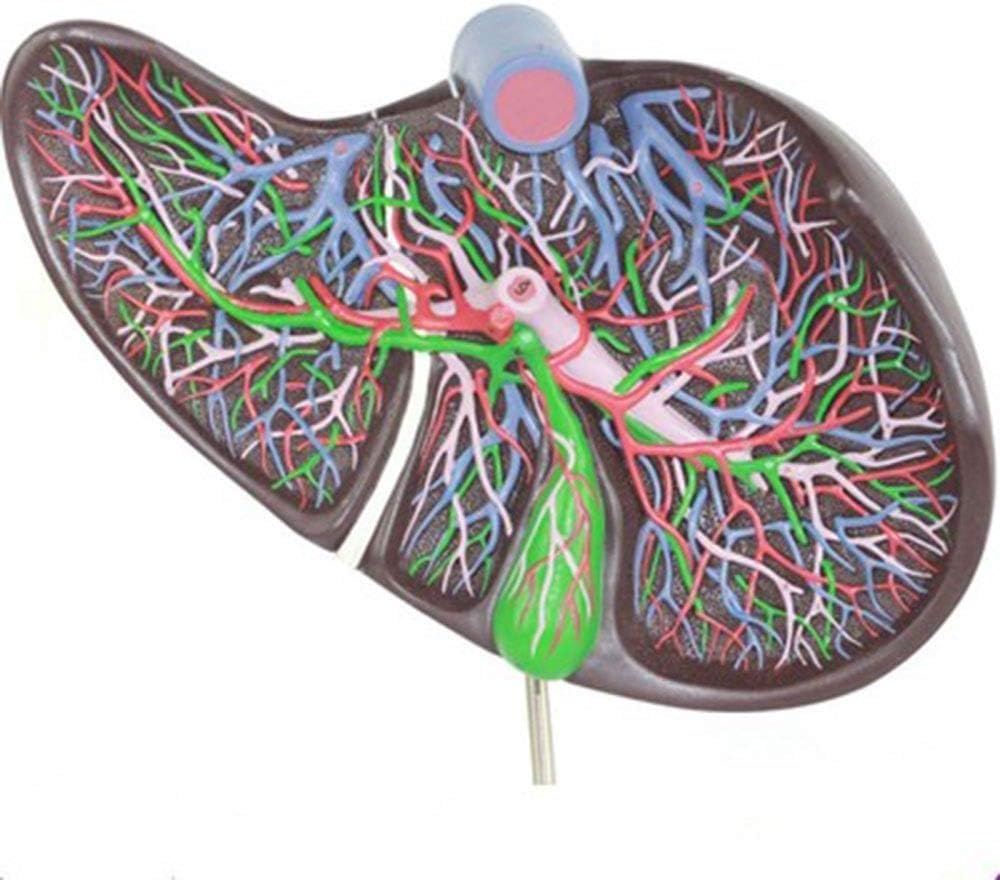 Amazon.com: KEZaiZHe Human Model, Gallbladder Anatomical Enlargement ...