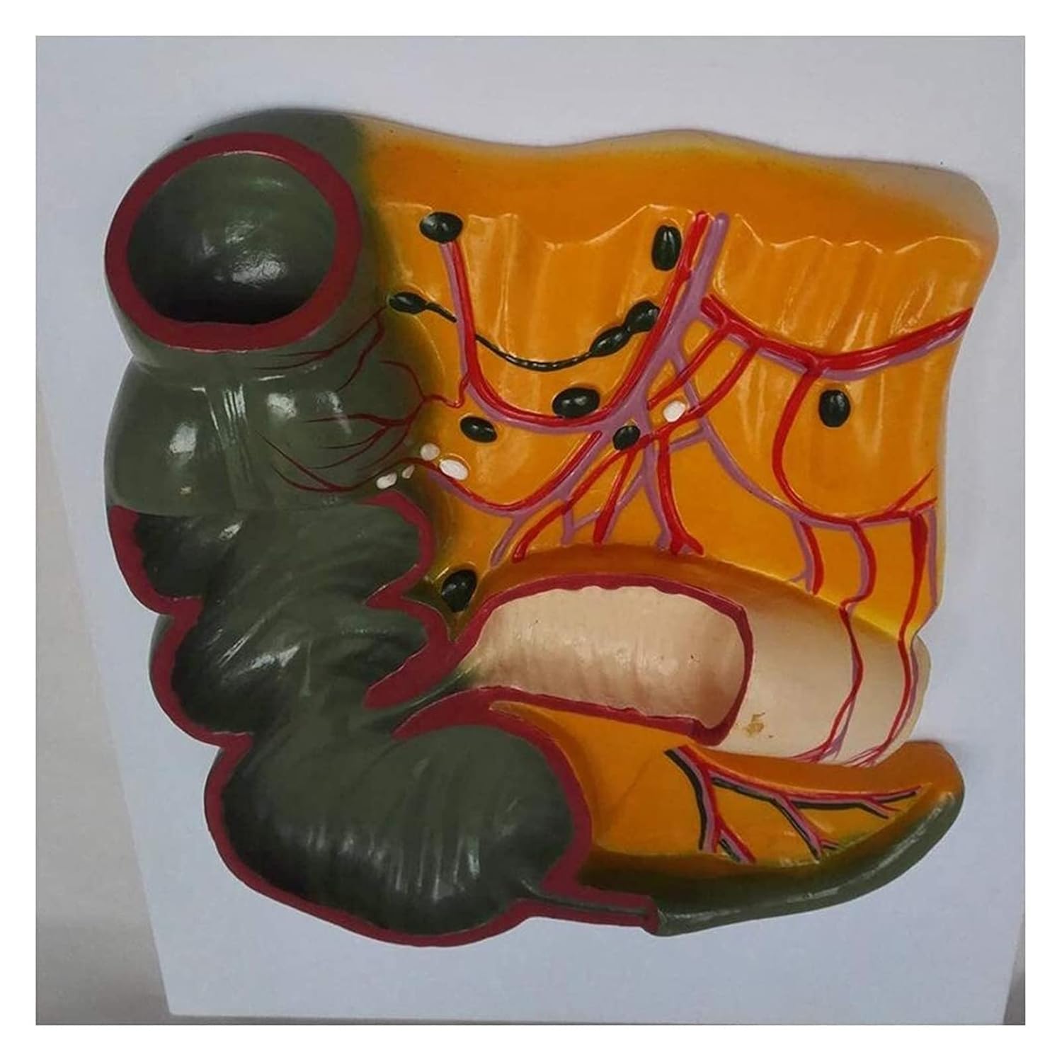 Anatomical Model, Intestinal Anatomical Model Human Appendix Cecum ...