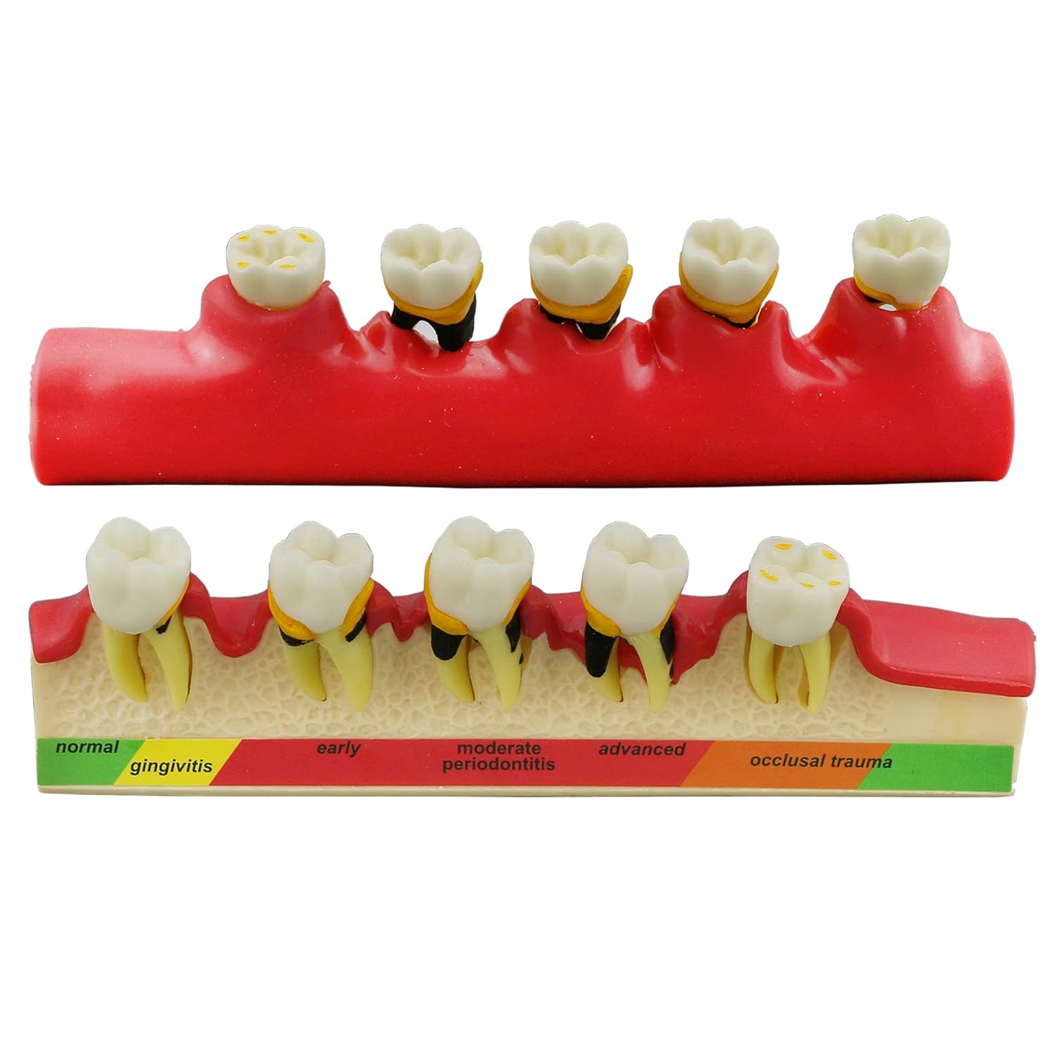 Periodontal Disease Classification Model - Philippines | Ubuy
