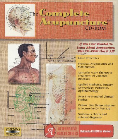 Complete Acupuncture (Alternative Health Series): 9781886649286: Amazon ...